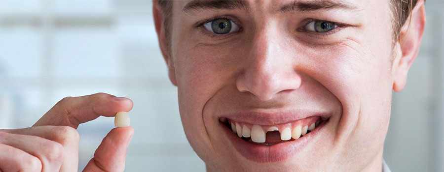 Tooth Lost and it's Consequences - My Dentist @ Boundary Park